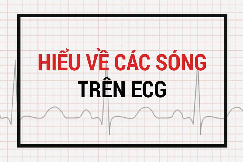 Đo điện tâm đồ là gì trong ngành y và ứng dụng trong thực tế